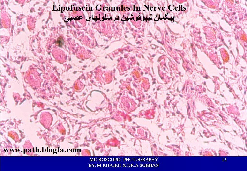نخستین آزمايشگاه آسيب شناسي اینترنتی